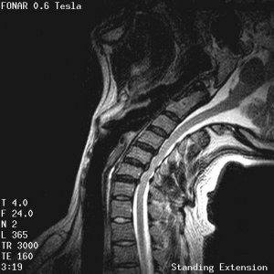 FONAR Upright (TM) MRI Image Gallery